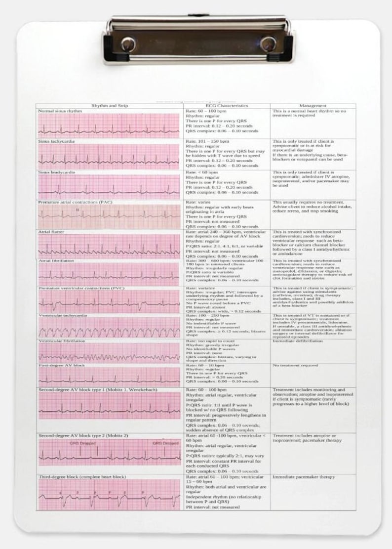 Cardiac Rhythm Nurse Clipboard – 13 Dysrhythmia Cheat Sheet, ECG ...