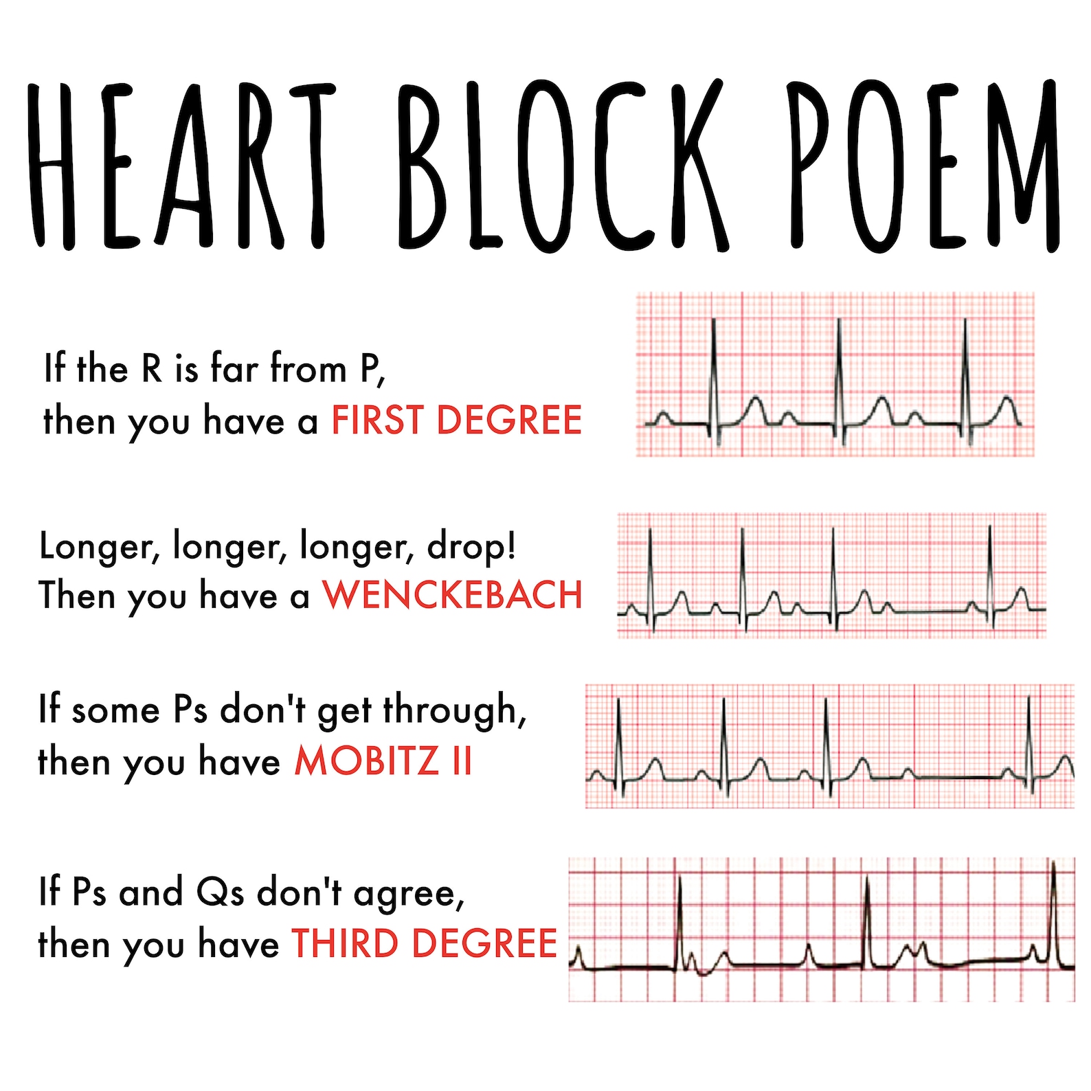 Heart Block Poem – Cardiac Rhythms Guide for Nurses, Funny ECG ...