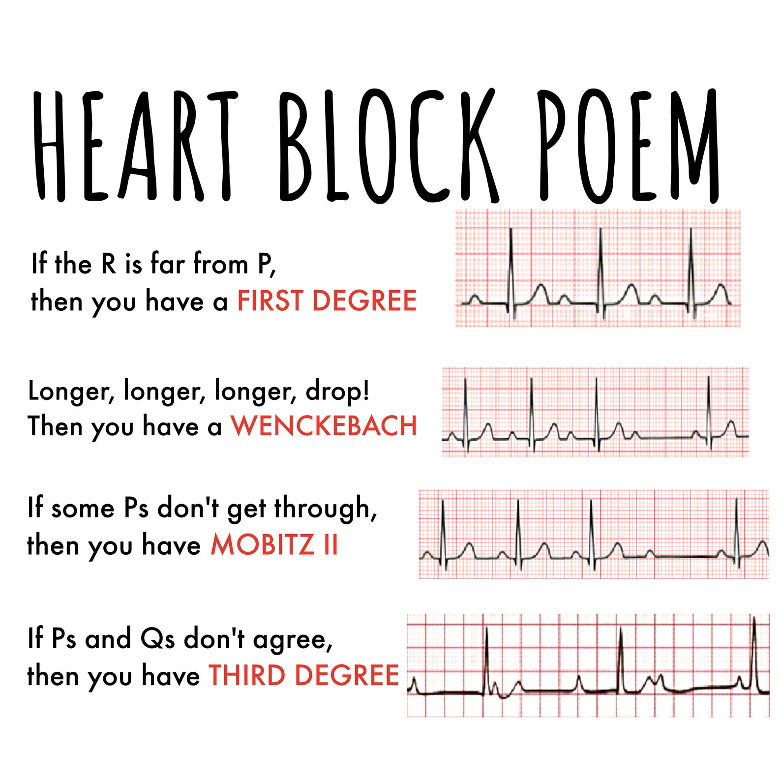 Heart Block Poem – Cardiac Rhythms Guide for Nurses, Funny ECG ...