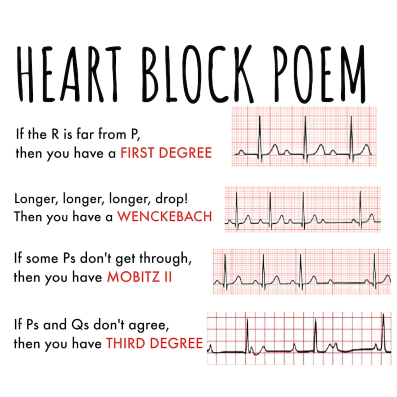 Heart Block Poem – Cardiac Rhythms Guide for Nurses, Funny ECG ...