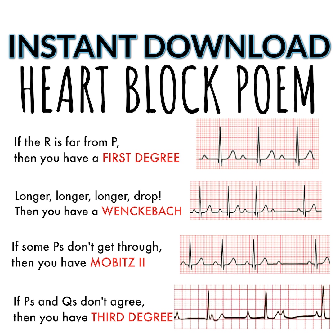 Cardiac Nurse Digital Download, Cardiac Rhythms for Nurse, Cardiac ...