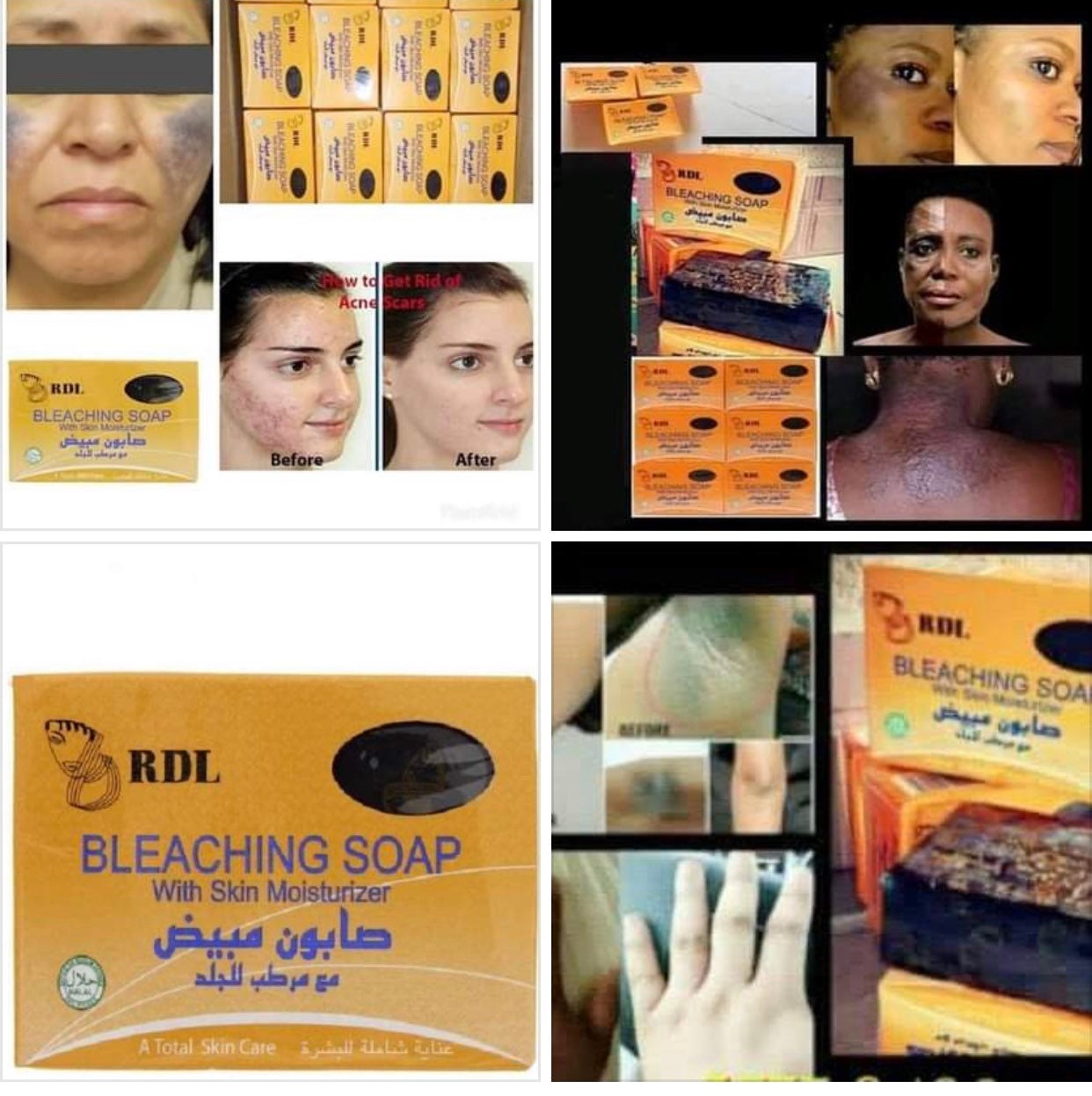 Bleaching Soap Before And After