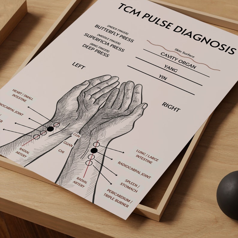 TCM Pulse Chart Poster, Traditional Chinese Medicine Pulse Reading Art ...