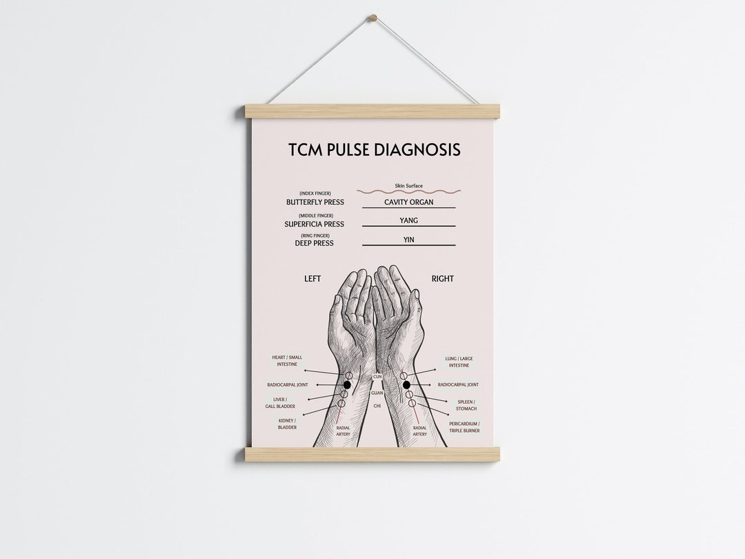 TCM Pulse Chart Poster, Traditional Chinese Medicine Pulse Reading Art ...