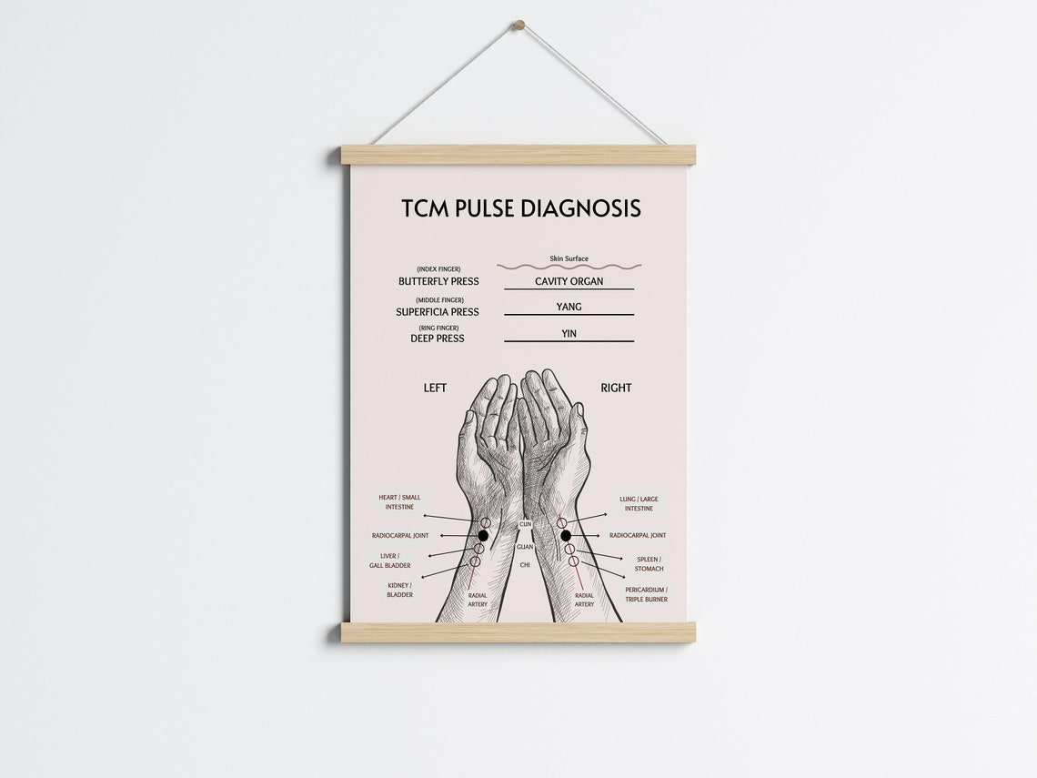 TCM Pulse Chart Poster, Traditional Chinese Medicine Pulse Reading Art ...