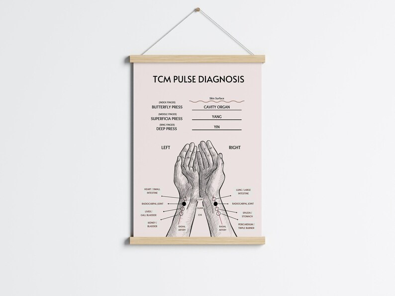 TCM Pulse Chart Poster, Traditional Chinese Medicine Pulse Reading Art ...