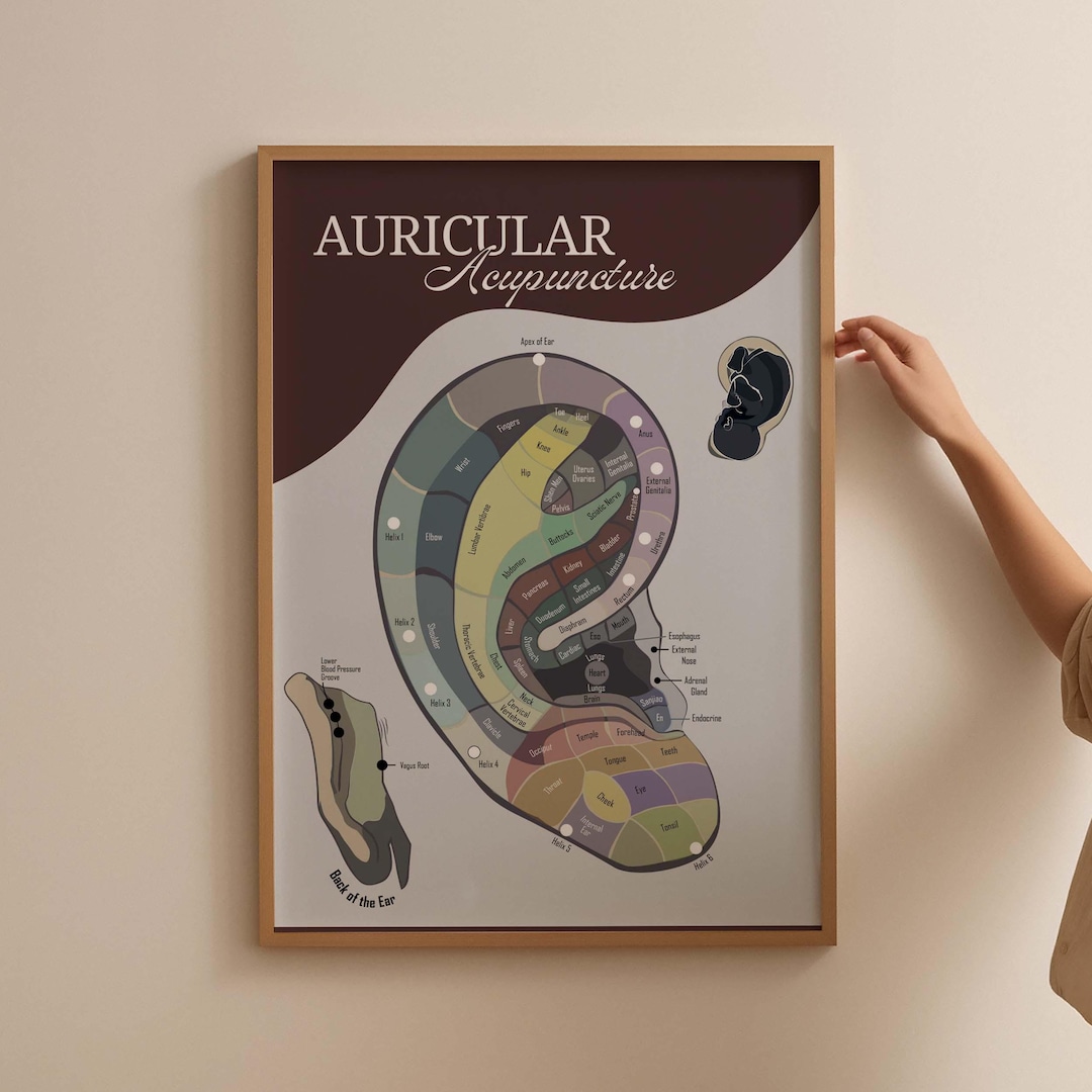 TCM Auricular Acupuncture Chart Poster, Ear Acupuncture Auriculotherapy ...