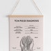 TCM Pulse Chart Poster, Traditional Chinese Medicine Pulse Reading Art ...