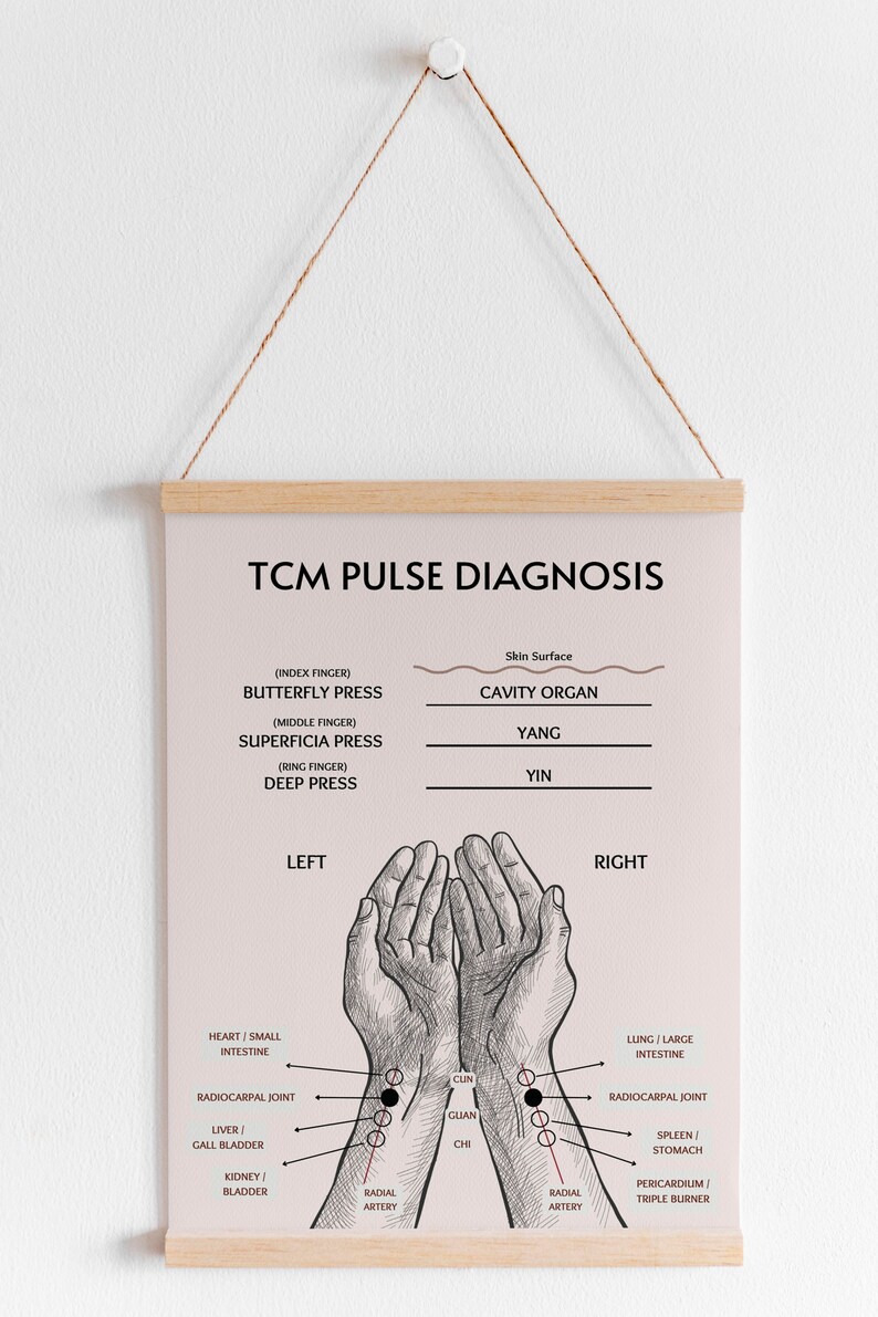 TCM Pulse Chart Poster, Traditional Chinese Medicine Pulse Reading Art ...