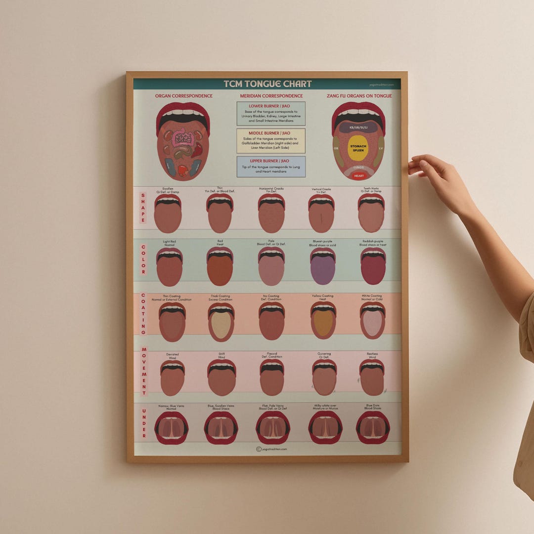 TCM Tongue Diagnosis Chart Poster, Tongue Types Traditional Chinese ...