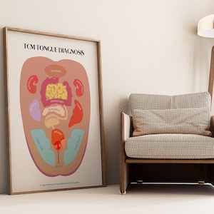 TCM Tongue Diagnosis Chart Poster, Traditional Chinese Medicine ...