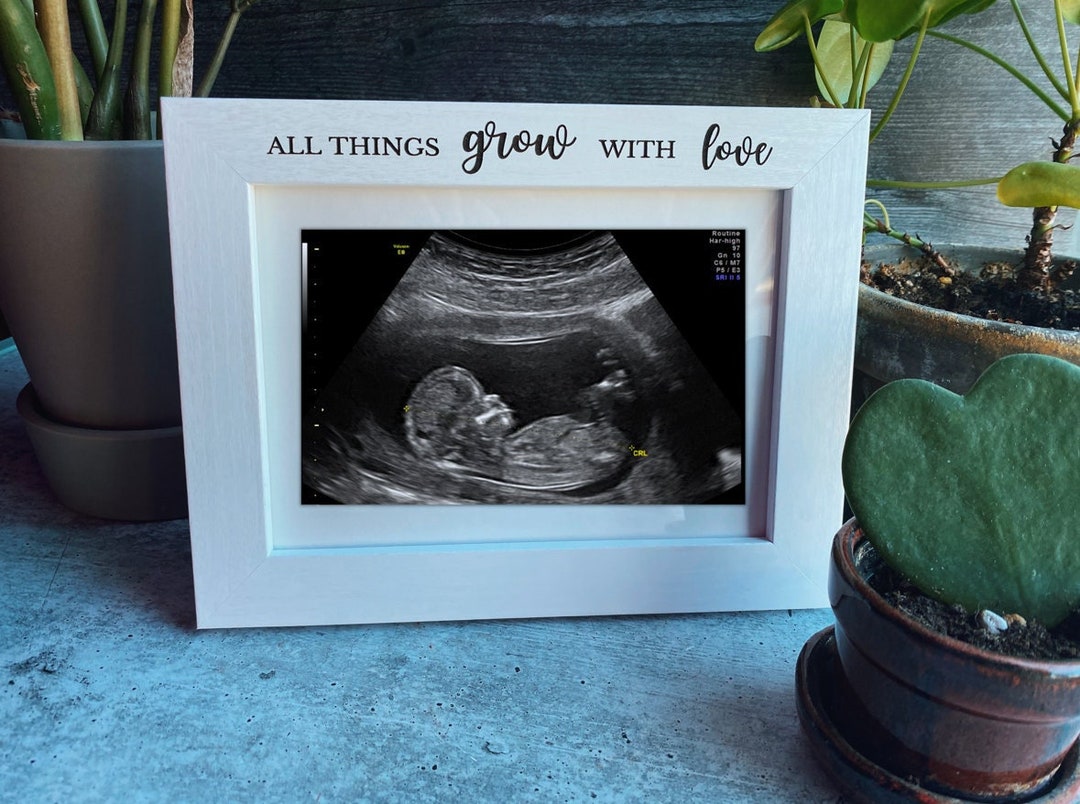 Baby Sonogram Picture Frame - Ultrasound Picture Frame - Baby ...