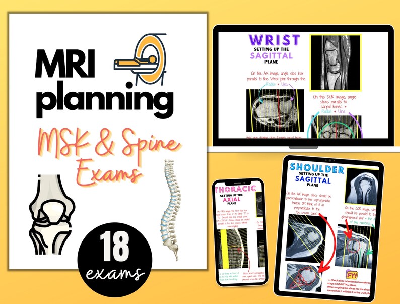 MRI Planning, MRI Positioning, Mri, Msk, Mri Study Guide, Mri Notes ...