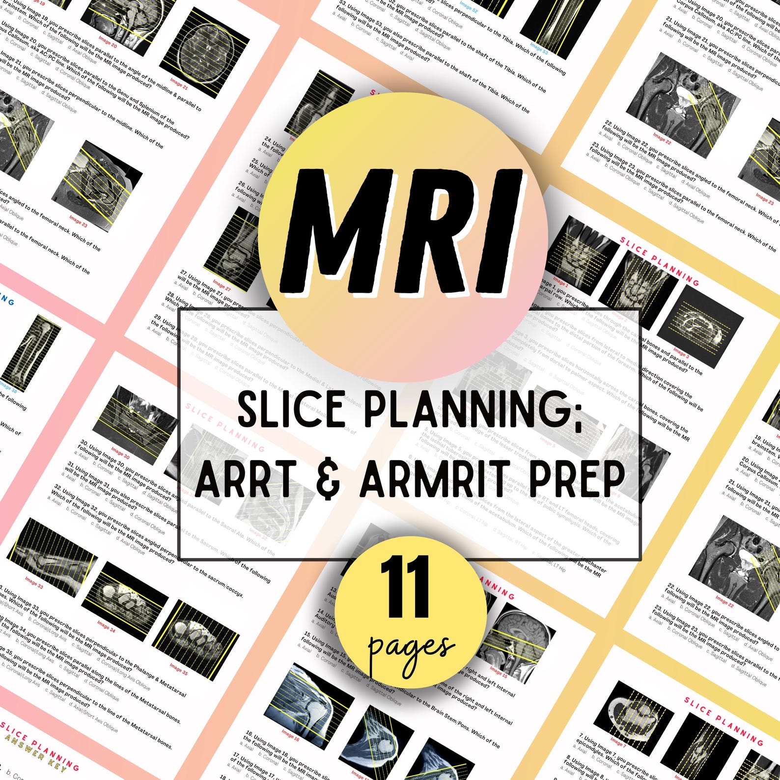 MRI Slice Planning, ARRT ARMRIT Study Guide, Mri Registry Exam, Mri ...