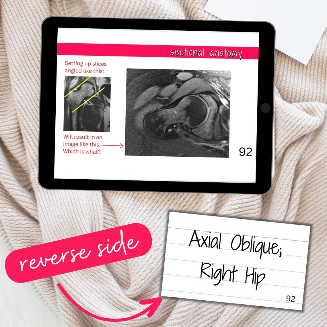 MRI Flashcards, Sectional Anatomy, Anatomy Notes, Mri Technologist, Mri ...