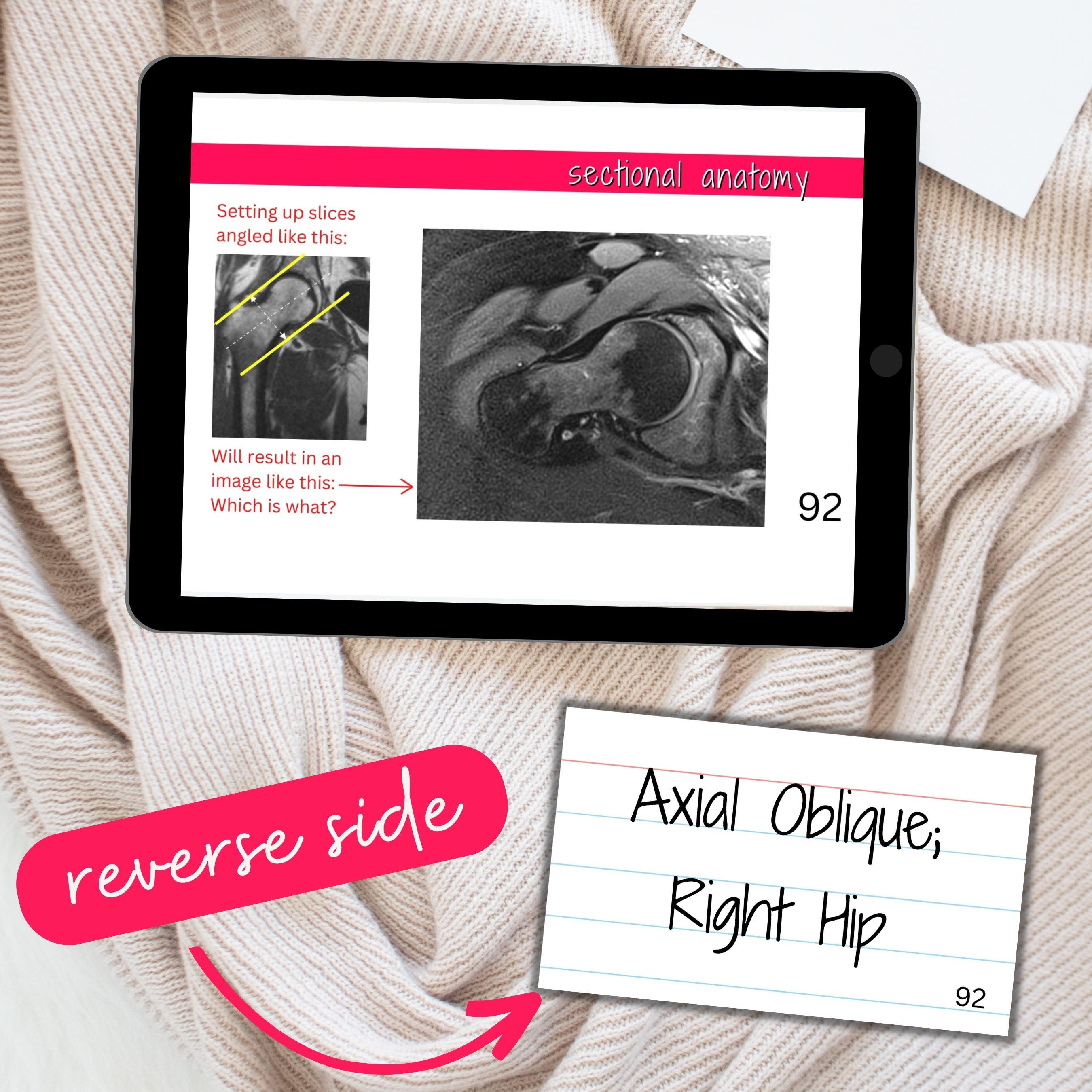 MRI Flashcards, Sectional Anatomy, Anatomy Notes, Mri Technologist, Mri ...