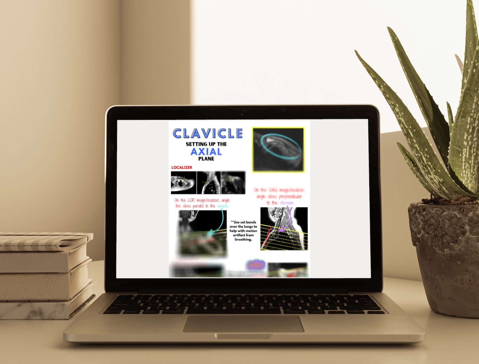 MRI Planning Chest and Abdomen, MRI Positioning, Mri, Mri Study Guide ...