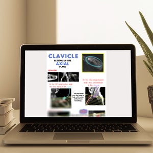 MRI Planning Chest and Abdomen, MRI Positioning, Mri, Mri Study Guide ...