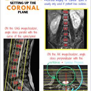 MRI Planning, MRI Positioning, Mri, Msk, Mri Study Guide, Mri Notes ...