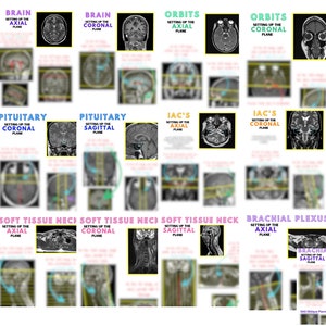 MRI Planning Notes, Head & Neck Exams (digital Download) - Etsy