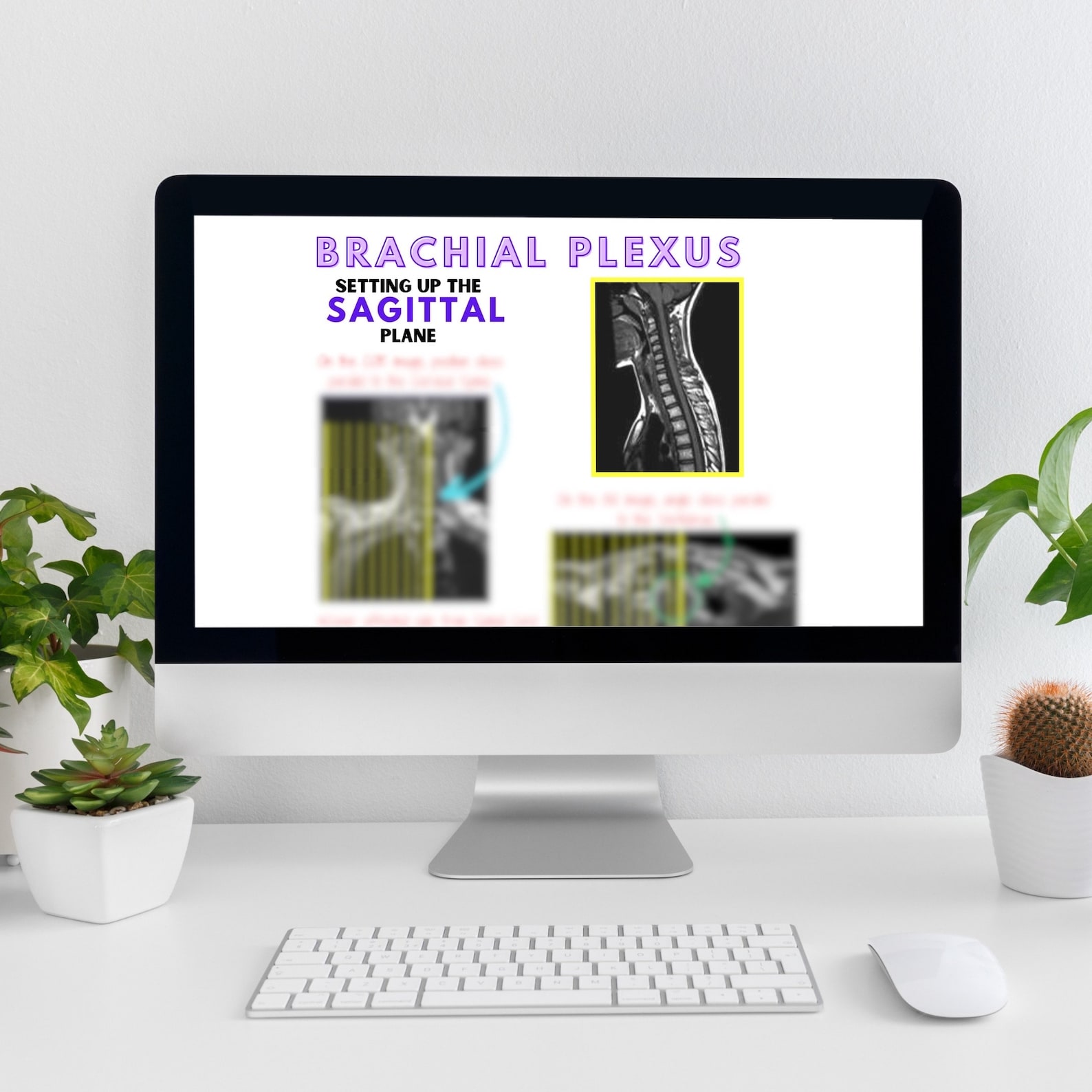 MRI Planning, MRI Positioning, Mri Neuro, Mri Study Guide, Mri Notes ...