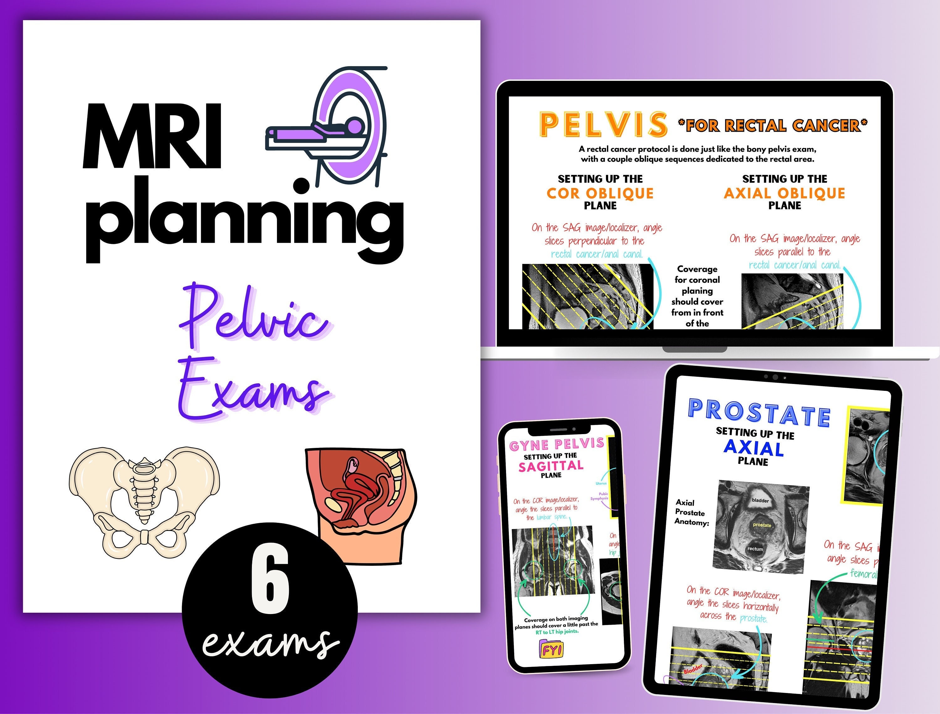MRI Planning Pelvis, MRI Positioning, Mri, Mri Study Guide, Mri Notes ...