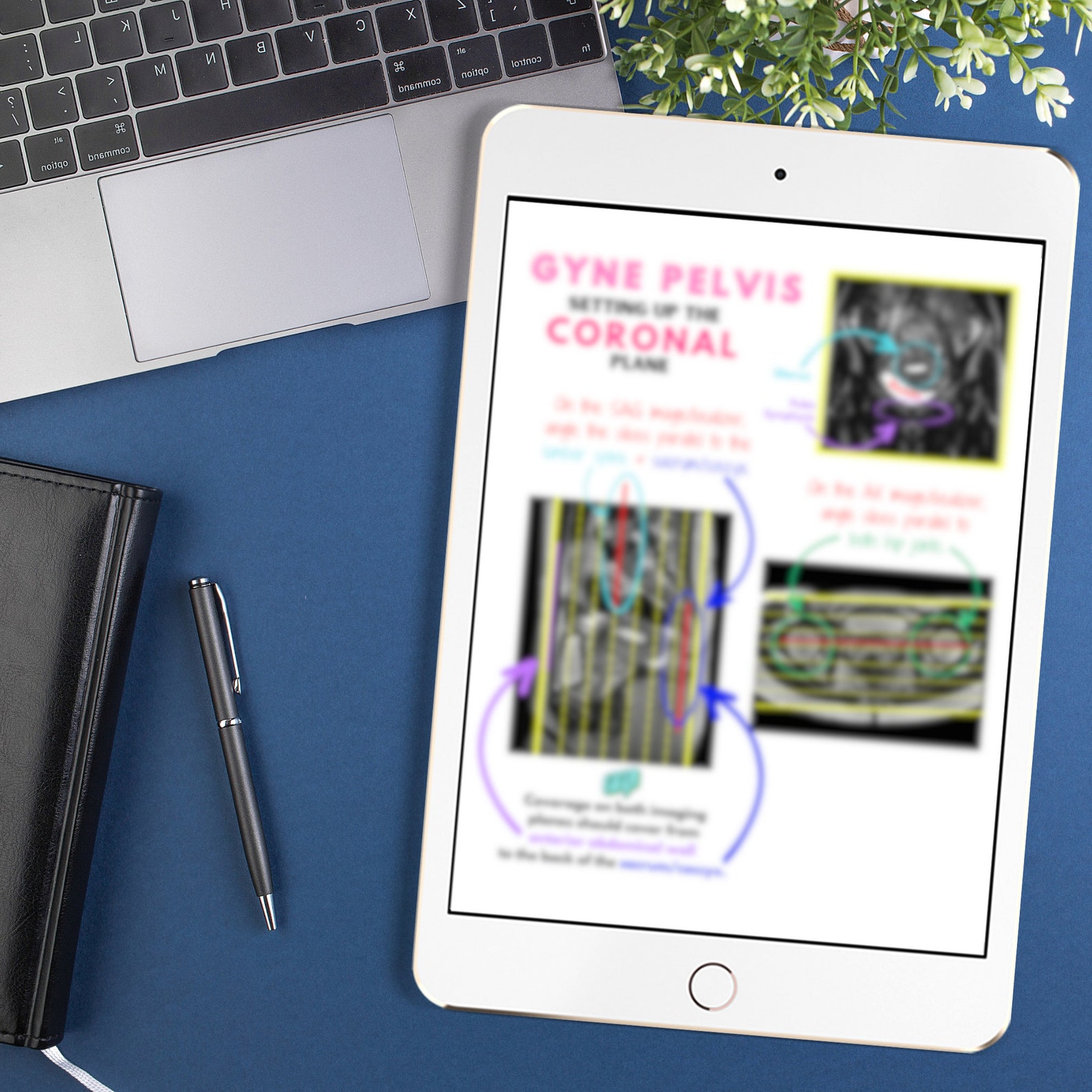 MRI Planning Pelvis, MRI Positioning, Mri, Mri Study Guide, Mri Notes ...