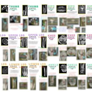 MRI Planning, MRI Positioning, Mri, Msk, Mri Study Guide, Mri Notes ...