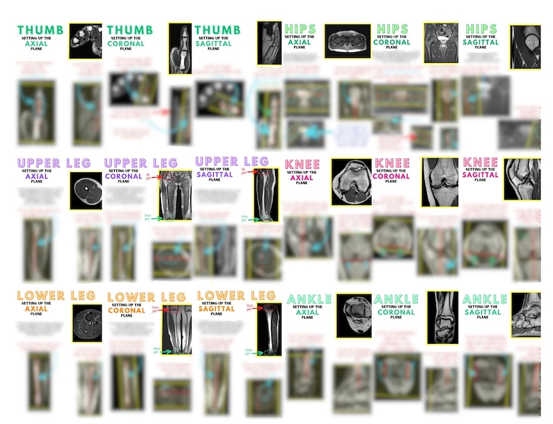 MRI Planning, MRI Positioning, Mri, Msk, Mri Study Guide, Mri Notes ...