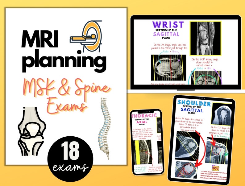 MRI Planning Study Guide, MSK & Spine, Digital Notes (PDF) - Etsy
