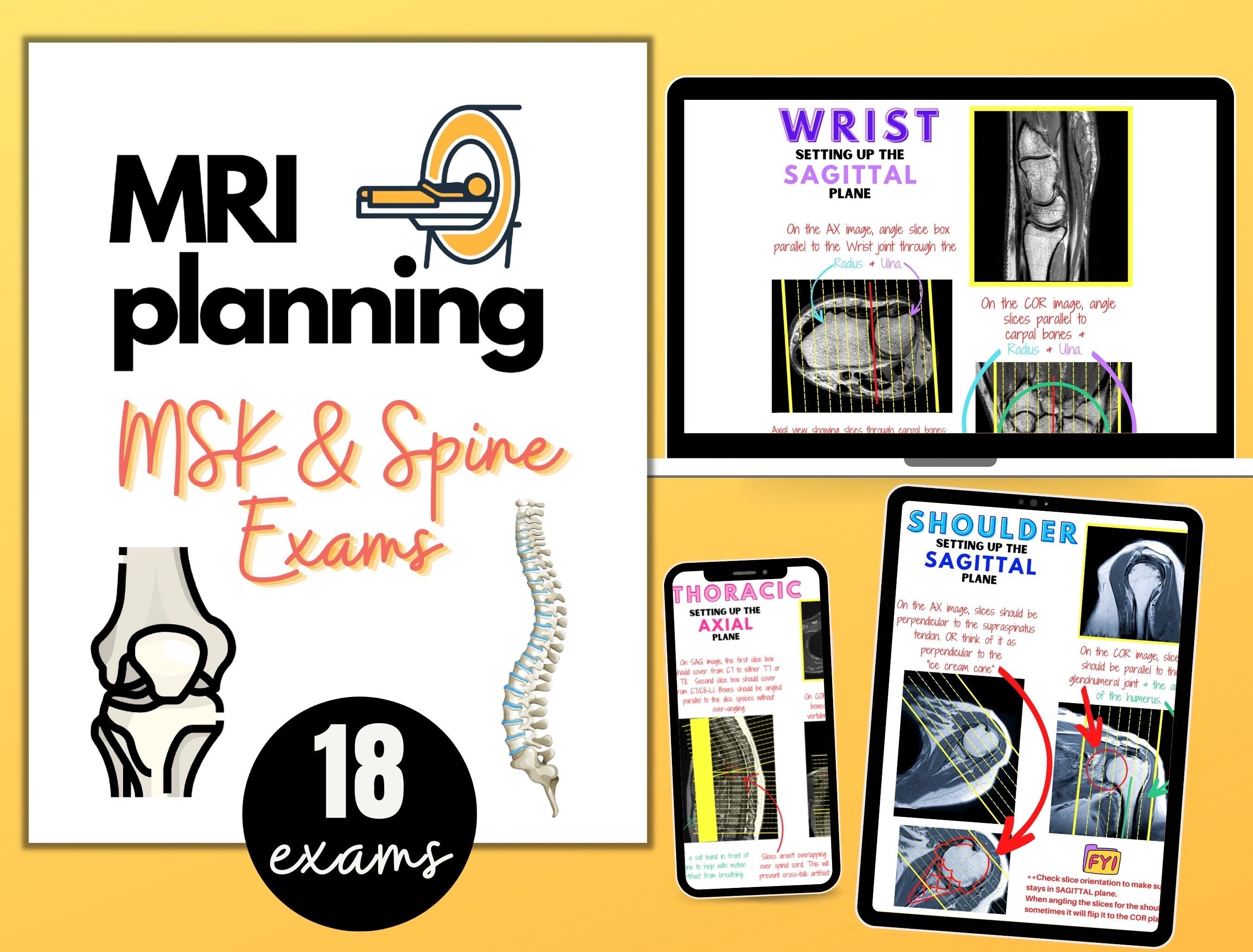 MRI Planning, MRI Positioning, Mri, Msk, Mri Study Guide, Mri Notes ...