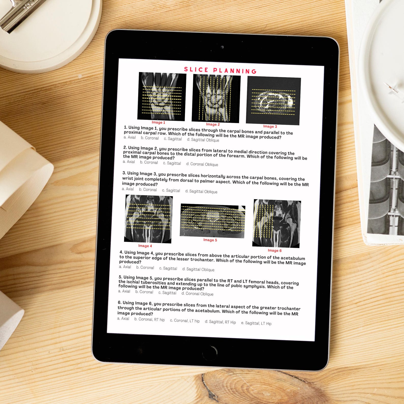 MRI Slice Planning, ARRT ARMRIT Study Guide, Mri Registry Exam, Mri ...