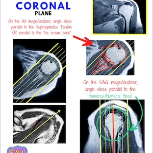 MRI Planning, MRI Positioning, Mri, Msk, Mri Study Guide, Mri Notes ...