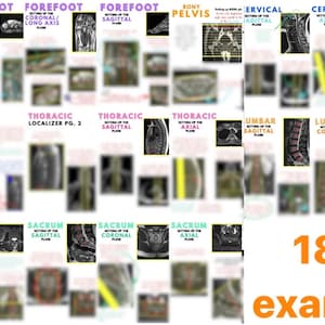 MRI Planning, MRI Positioning, Mri, Msk, Mri Study Guide, Mri Notes ...