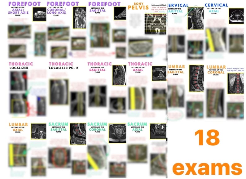 MRI Planning, MRI Positioning, Mri, Msk, Mri Study Guide, Mri Notes ...