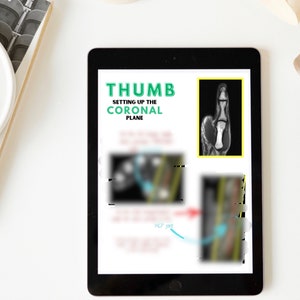 MRI Planning Study Guide, MSK & Spine, Digital Notes (PDF) - Etsy