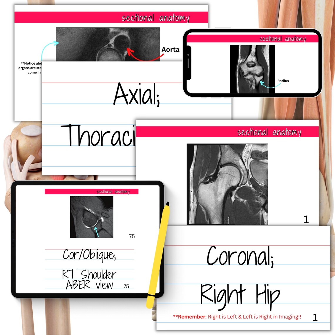 MRI Flashcards, Sectional Anatomy, Anatomy Notes, Mri Technologist, Mri ...