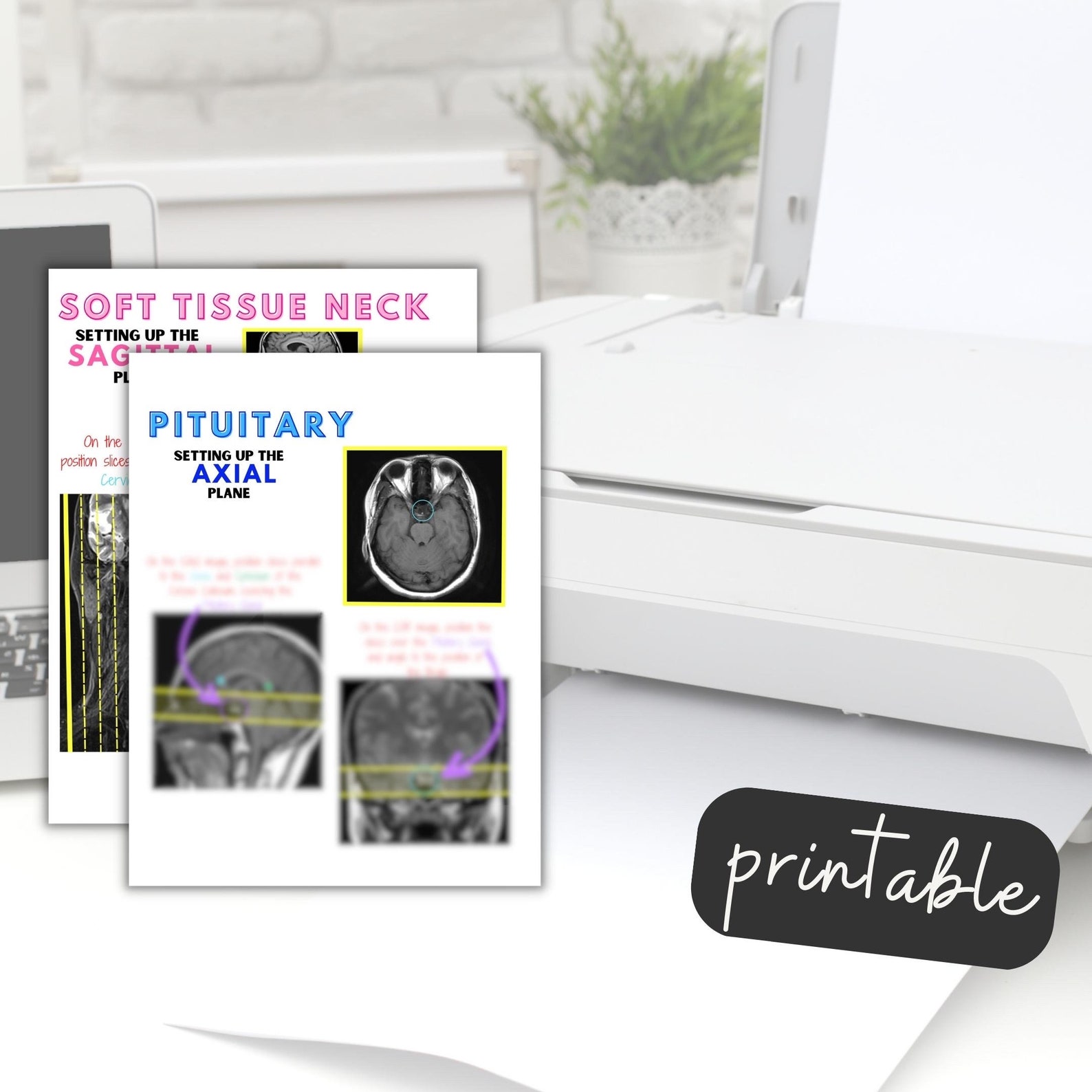 MRI Planning, MRI Positioning, Mri Neuro, Mri Study Guide, Mri Notes ...