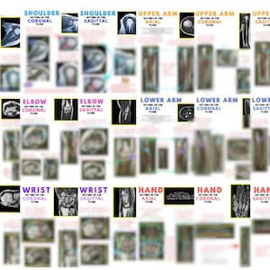 MRI Planning, MRI Positioning, Mri, Msk, Mri Study Guide, Mri Notes ...