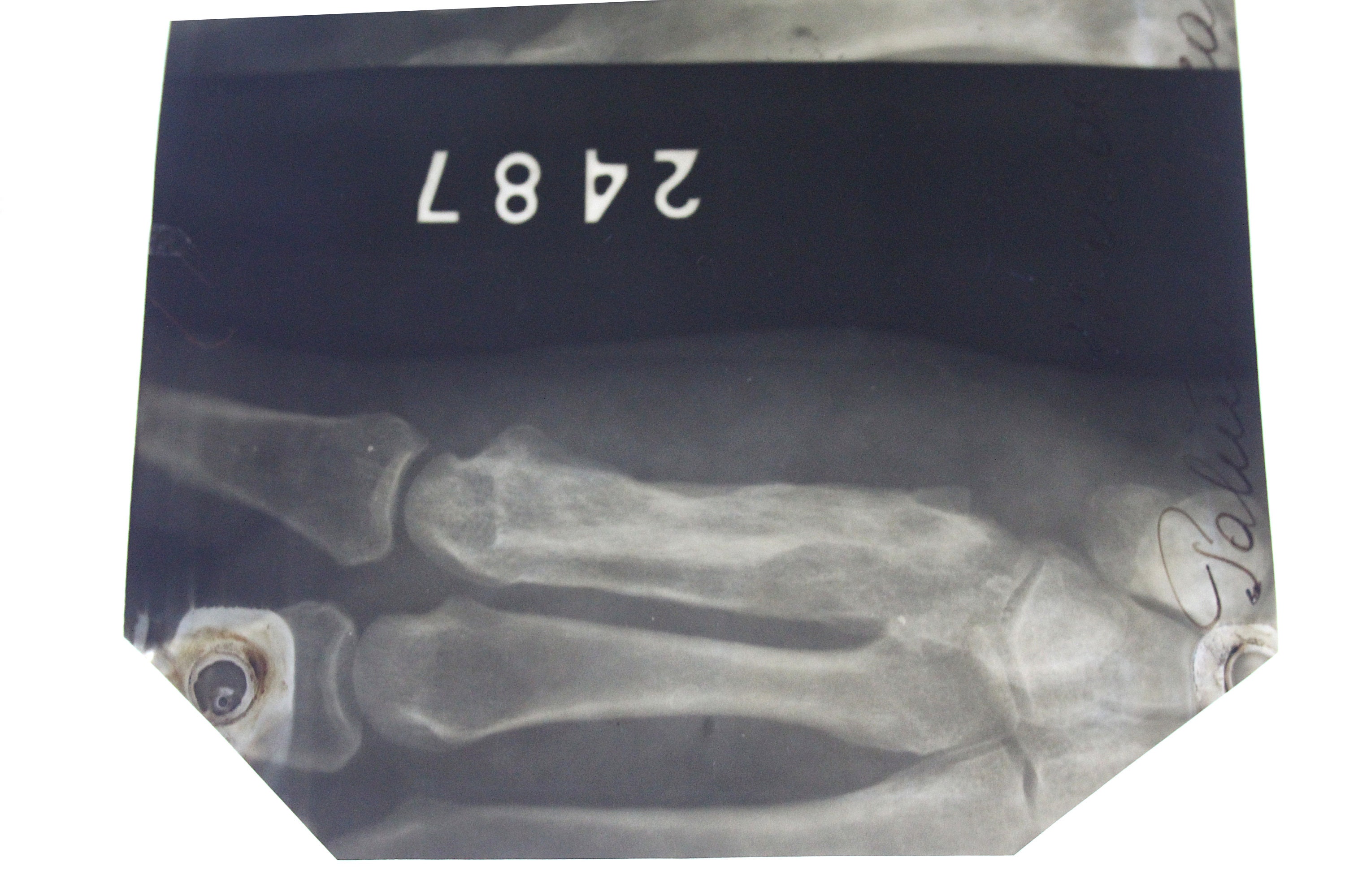 Real X-ray of a Human, X-ray of a Human Hand, X-ray of Fingers - Etsy