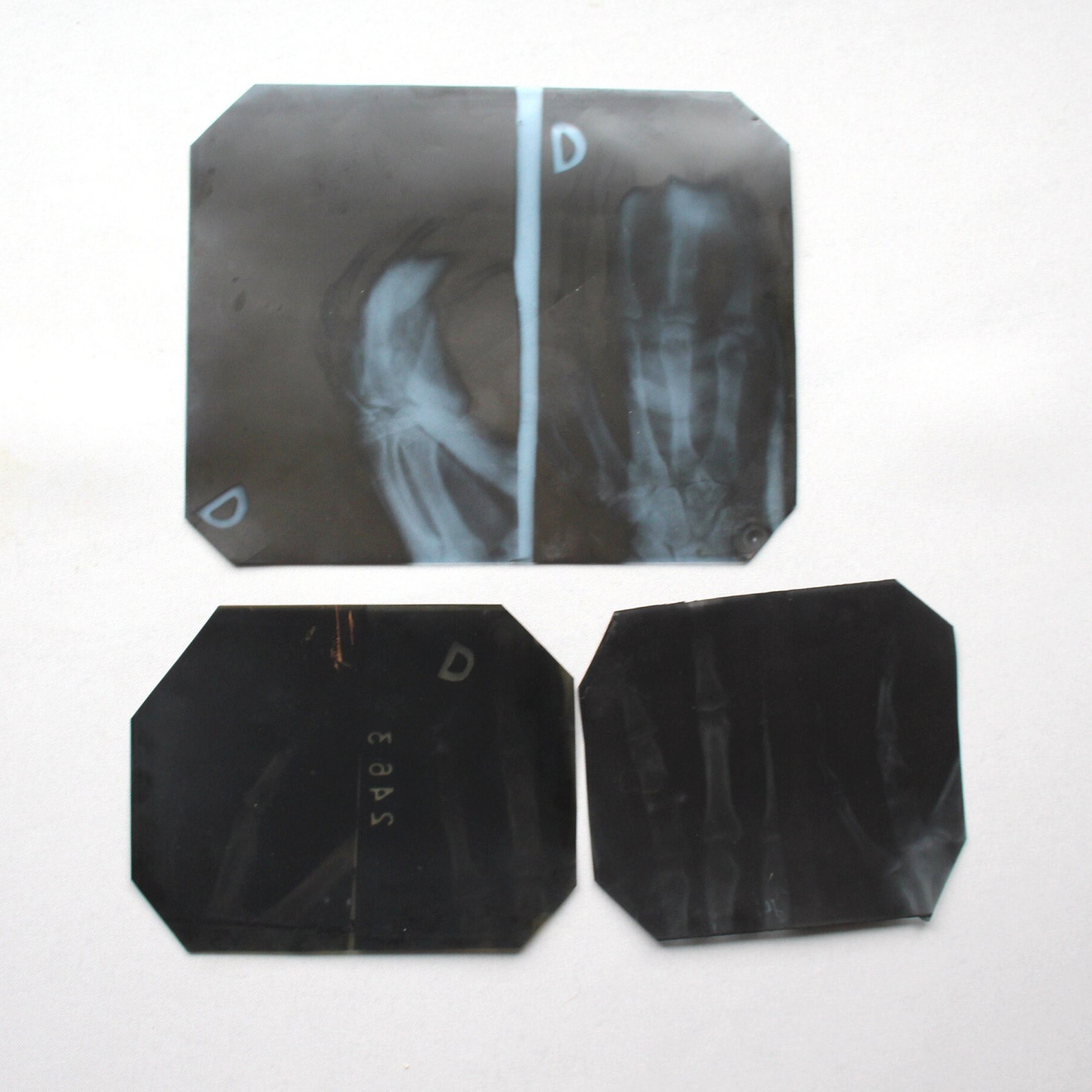 Real Human X-ray , X-ray of a Hand, Vintage X-ray - Etsy