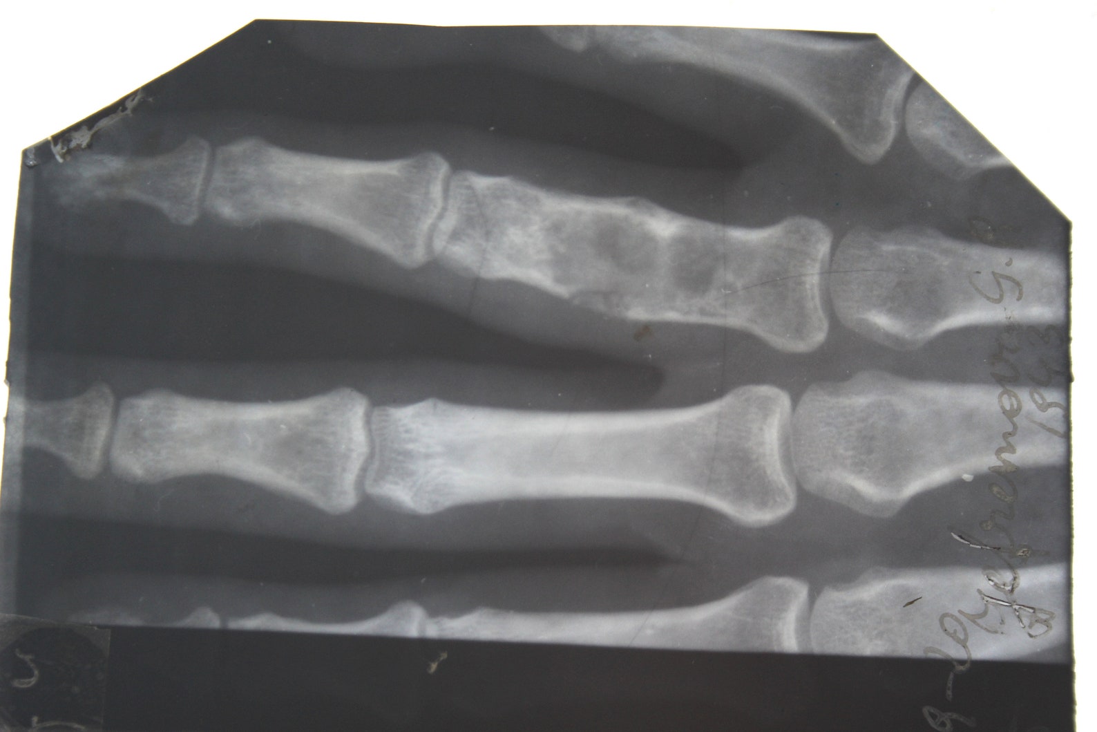 Real Human X-ray X-ray of a Hand Vintage X-ray - Etsy