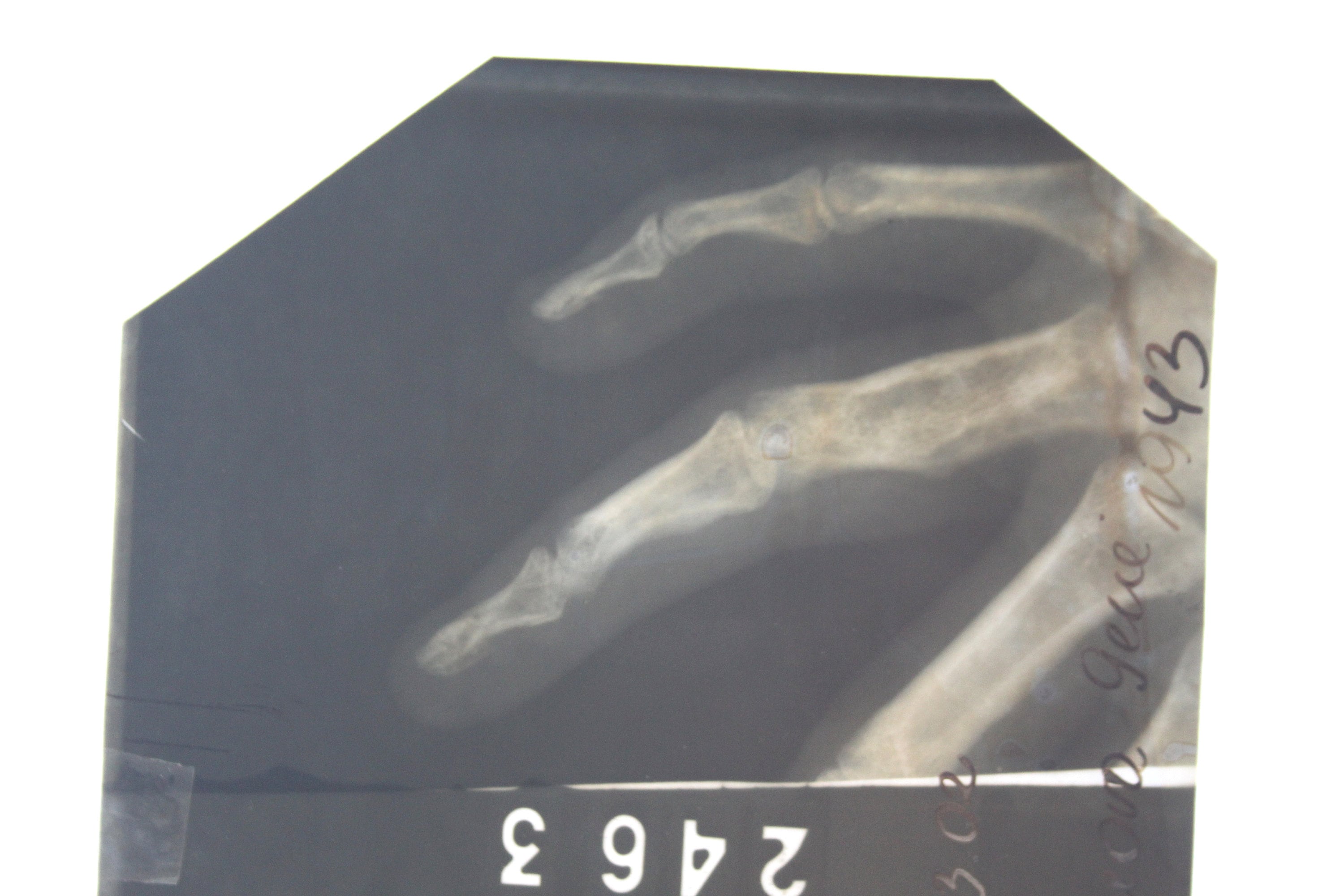 Real Human X-ray , X-ray of a Hand, Vintage X-ray - Etsy