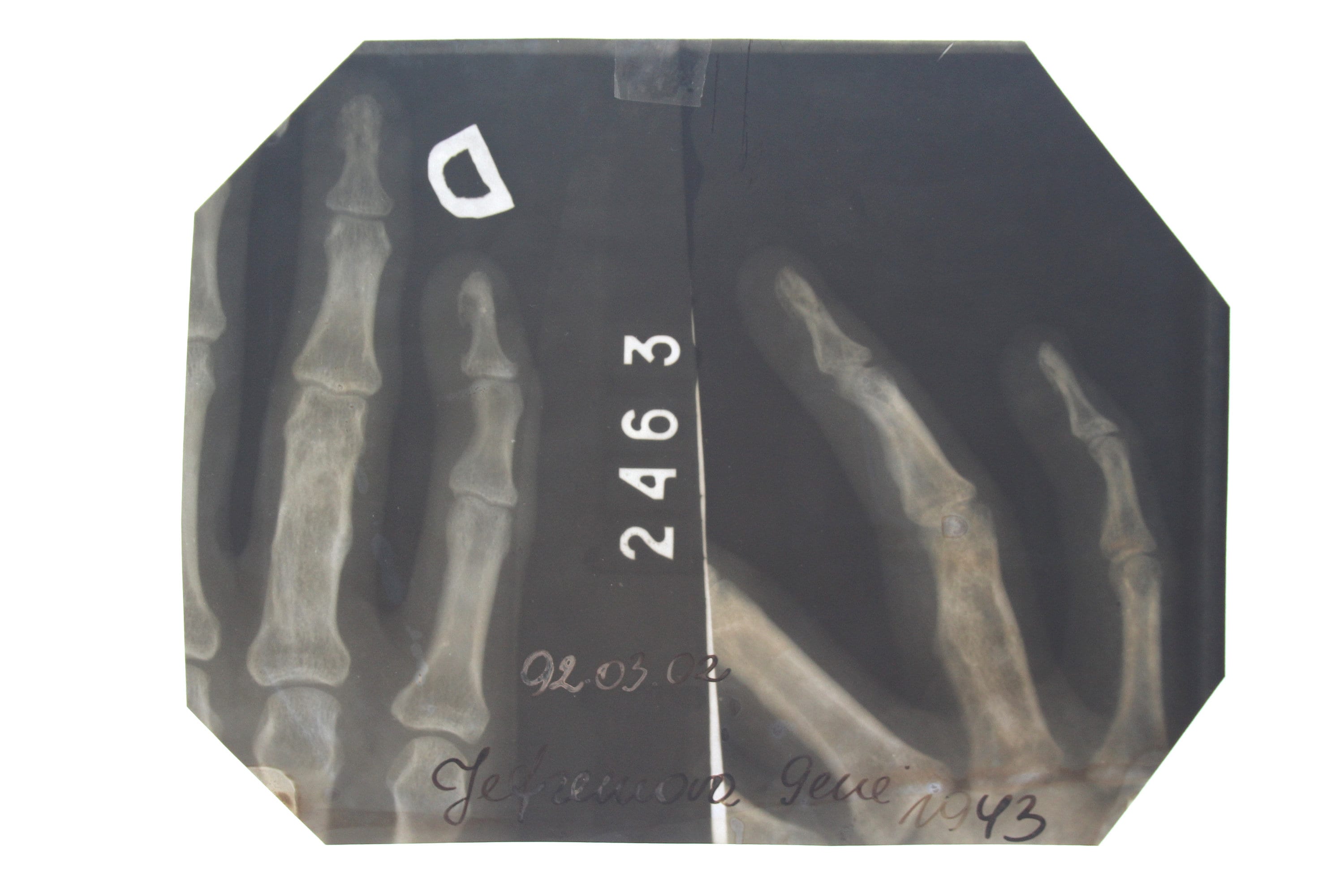 Real Human X-ray , X-ray of a Hand, Vintage X-ray - Etsy