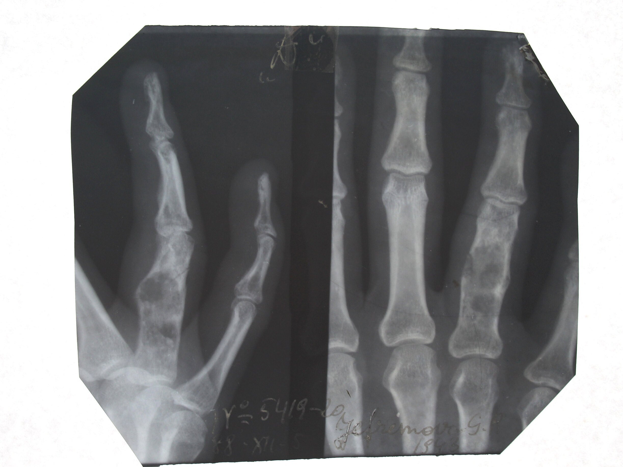 Real Human X-ray , X-ray of a Hand, Vintage X-ray - Etsy