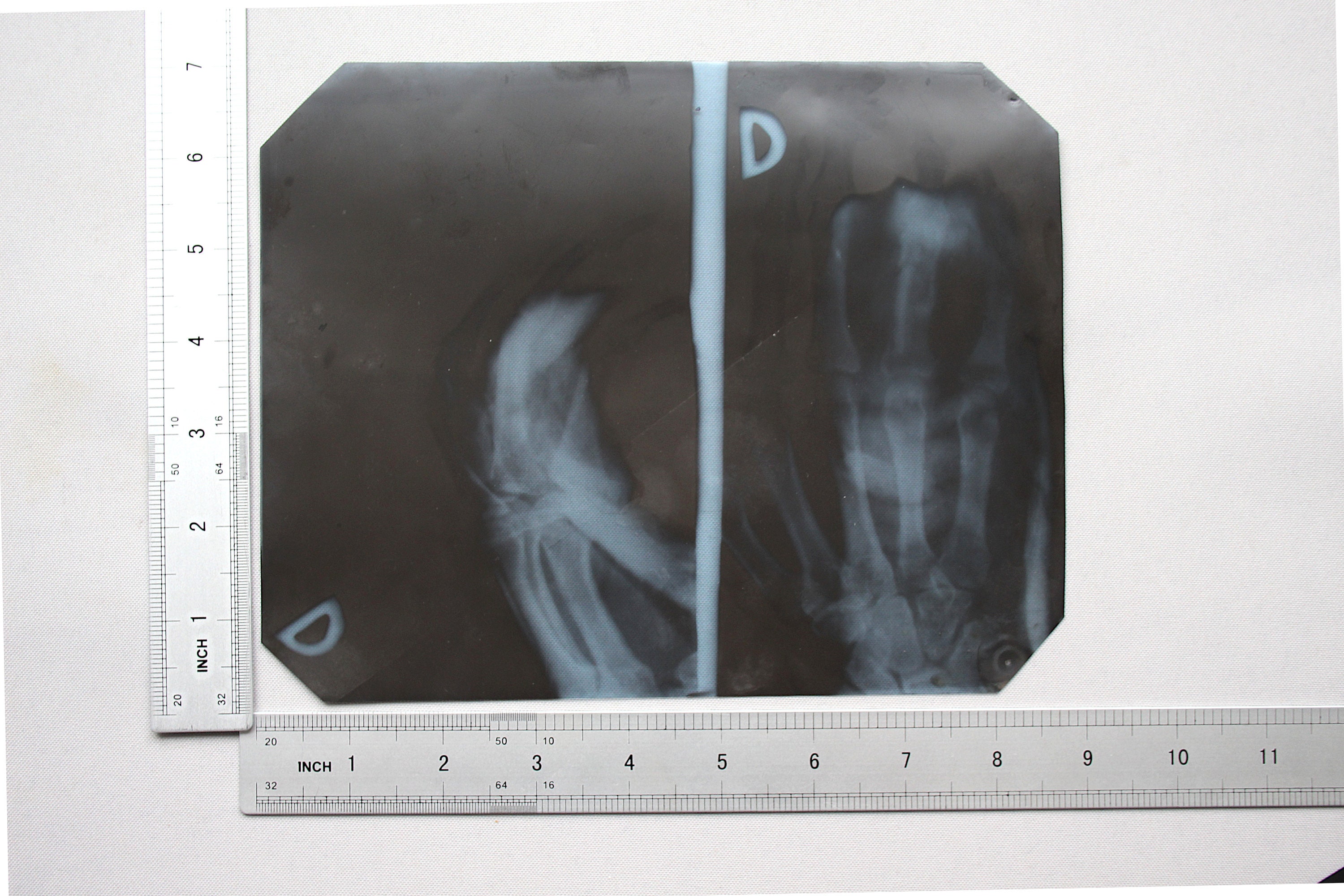 Real Human X-ray X-ray of a Hand Vintage X-ray - Etsy