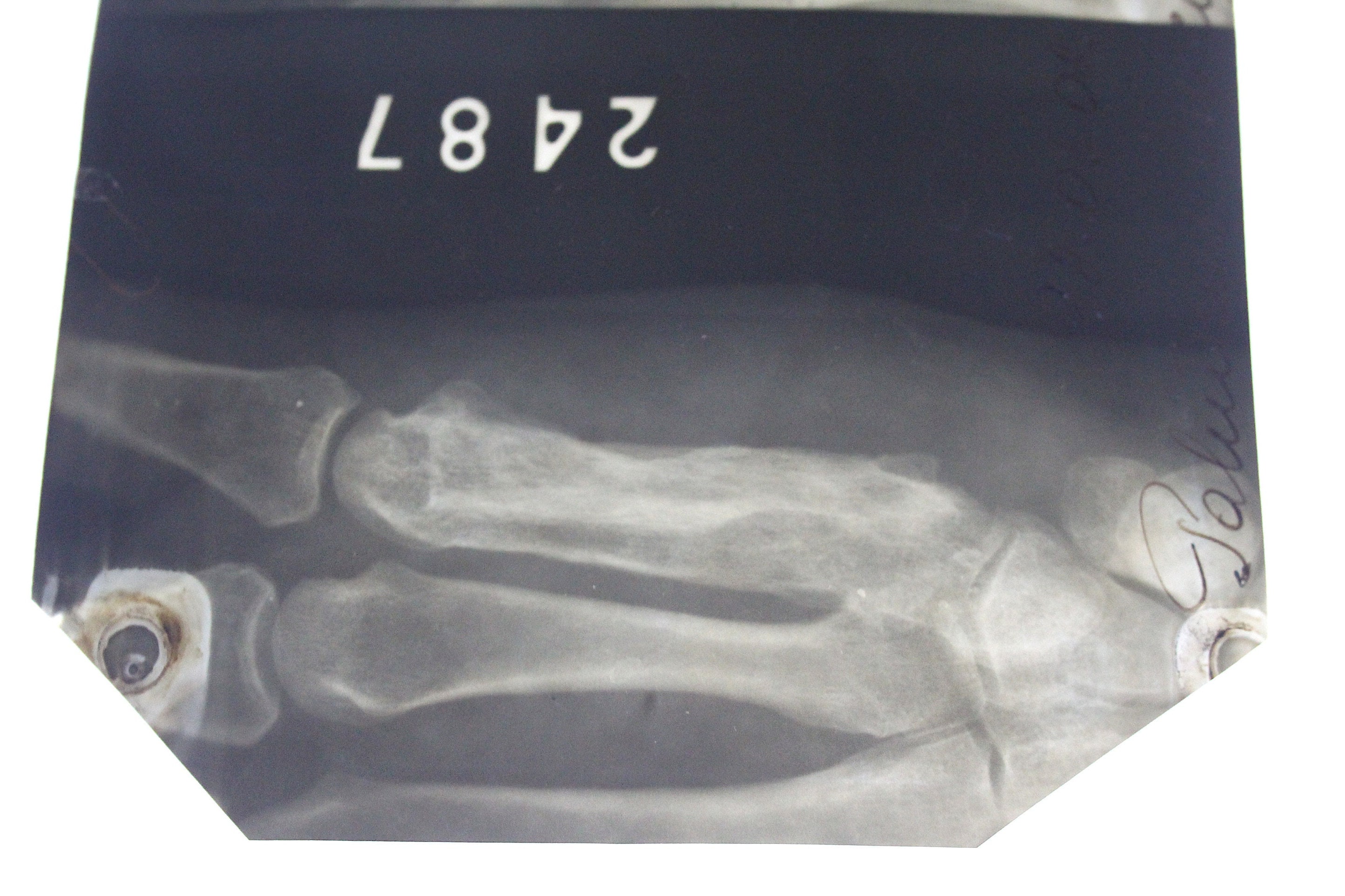 Real X-ray of a Human, X-ray of a Human Hand, X-ray of Fingers - Etsy