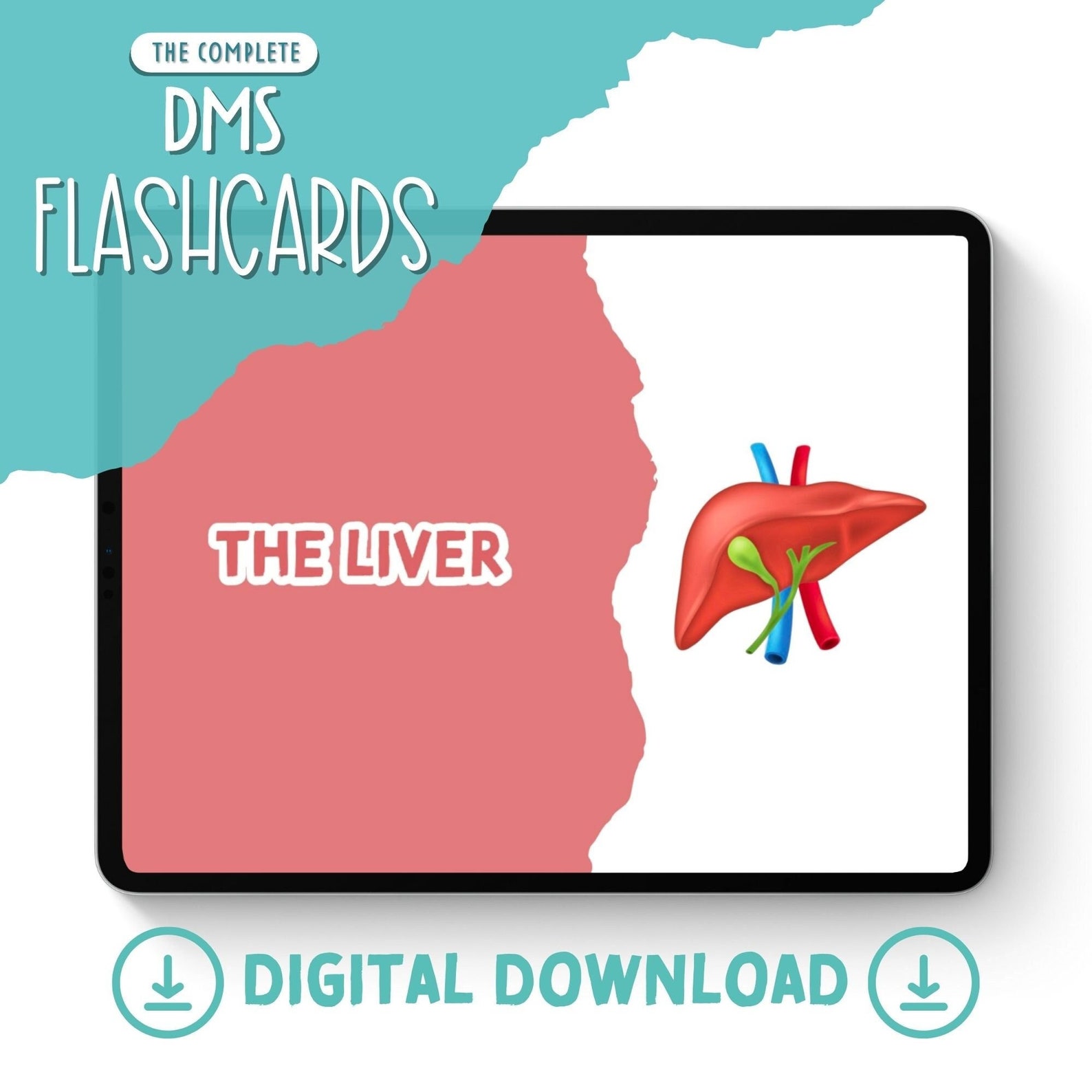 Ultrasound School Abdomen Flashcards, Ultrasound Student Study Notes ...