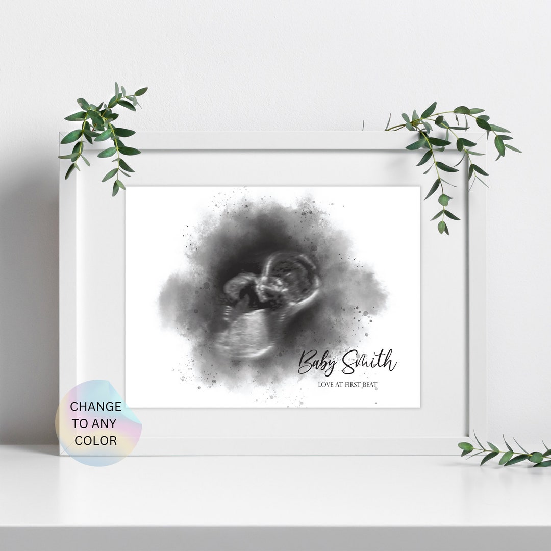 Ultrasound Print Art, Watercolor Ultrasound Print, Custom Birth ...