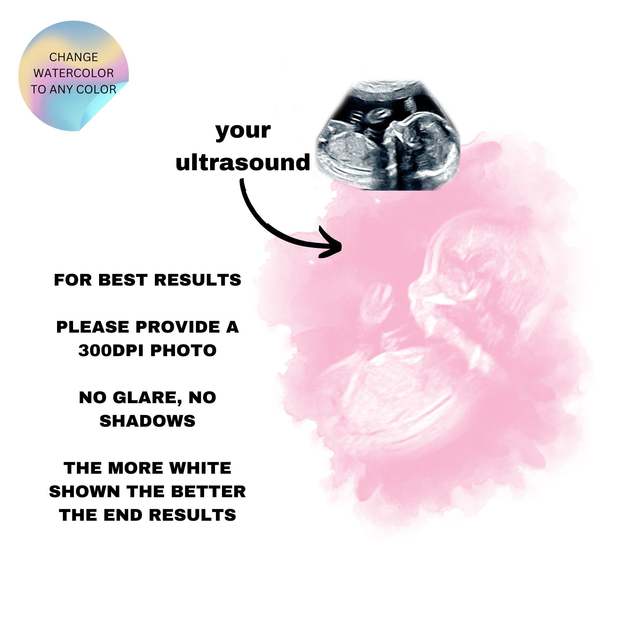 Ultrasound Print Art Watercolor Ultrasound Print Custom - Etsy